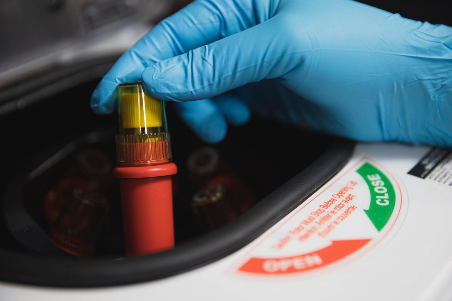 Platelet-Rich Fibrin Matrix (PRFM) in Dallas | Spa in the City