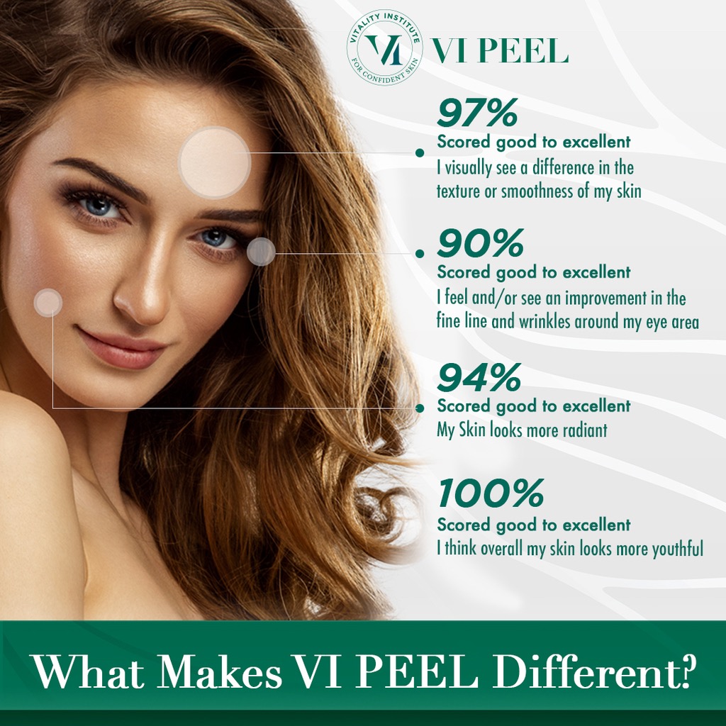 Spa in the City | VI Peel Dallas | VI Peel Treatment | VI Peel Services ...